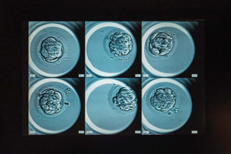 EmbryoScope and the future of IVF: how technology is changing fertility ...